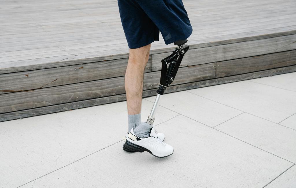 What Do Prosthetists Do? A Comprehensive Look at Their Role in ...